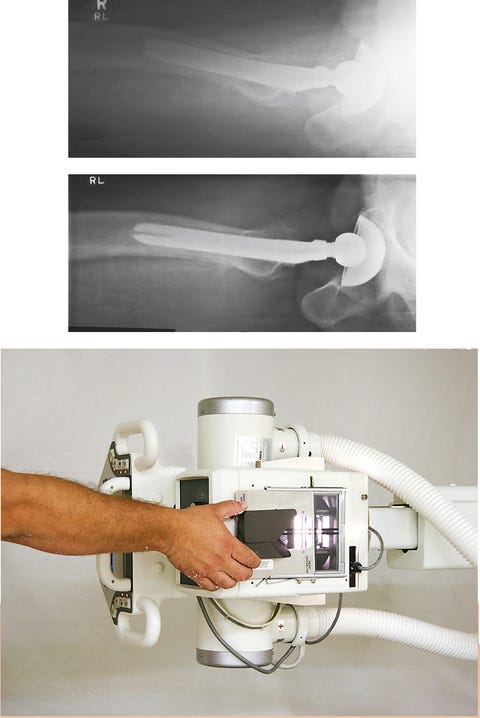 X-Ray Compensating Filter Market Revenue and Gross Margin ...