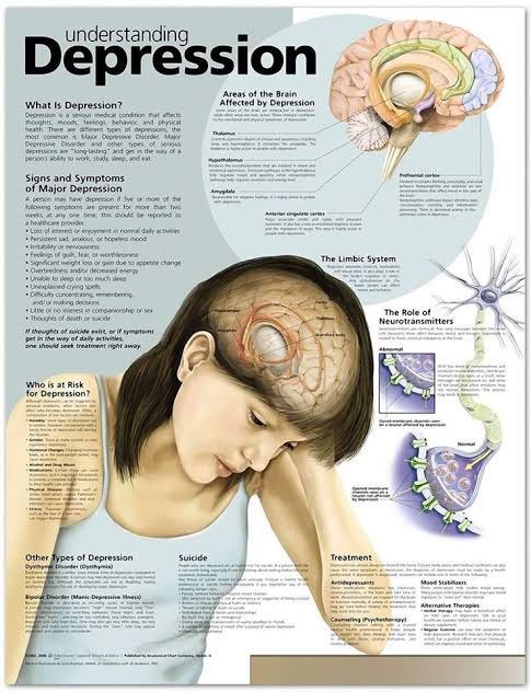 TOPIC DEPRESSION… Depression refers to a mood disorder characterized by ...
