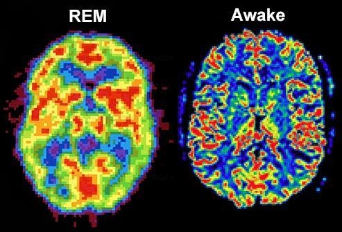The Primacy of REM Sleep: A Deep Dive into Sleep Scheduling and Phases ...