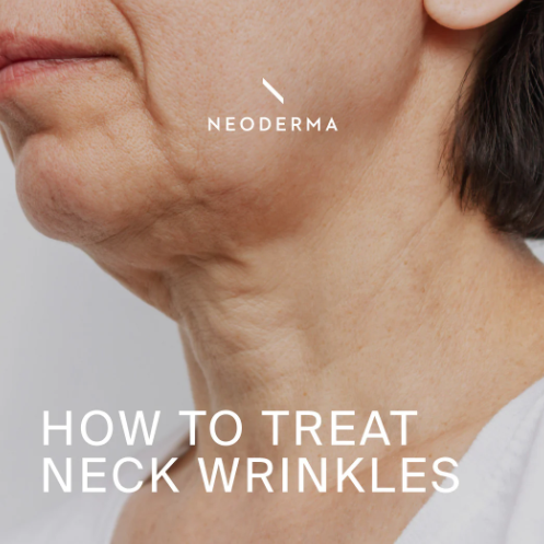 Neck Wrinkles | NEODERMA. Neck wrinkles are a common concern as… | by ...