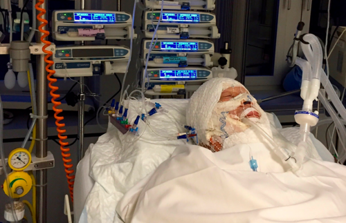 Wounded. In October of 2018 Elder Neil L… | by Clifford Maxwell | Medium