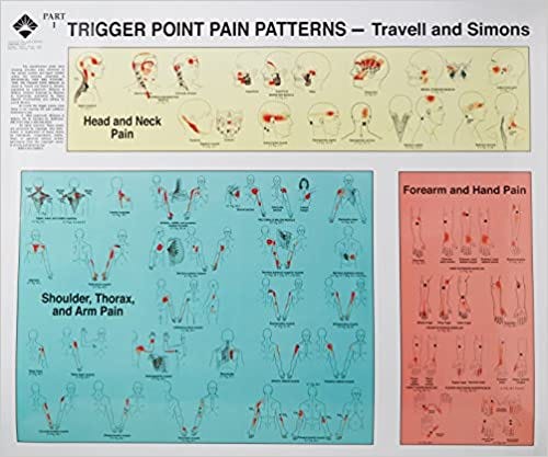 READ/DOWNLOAD$= Trigger Points of Pain: Wall Chart | by READ/DOWNLOAD ...