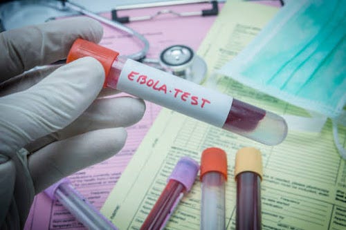 Blood Test Breakthrough: Predicting Alzheimer’s | by Pawarnihal | Jan ...