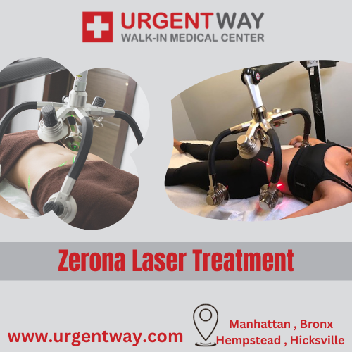 If I want Zerona Laser Treatment, do I have to wear a compression garment all day every day ...