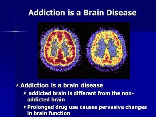 Addiction: Where we need to go. Addiction is both a chronic brain… | by ...