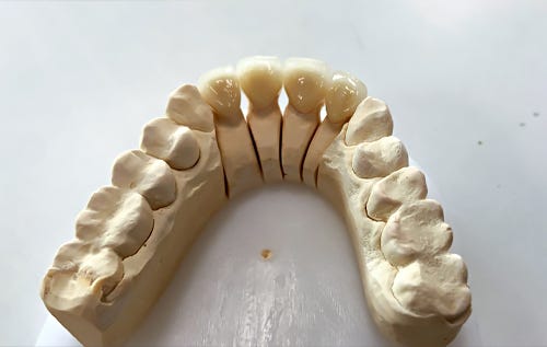 Top Chinese Outsourcing Dental Lab - Newstar Dental lab - Medium