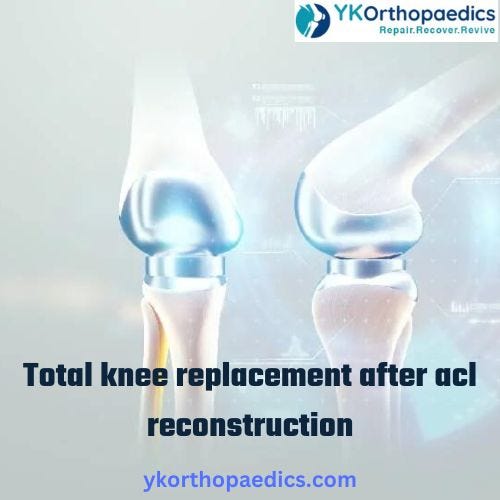 Expert Knee Care Post-ACL Reconstruction at ykorthopaedics ...