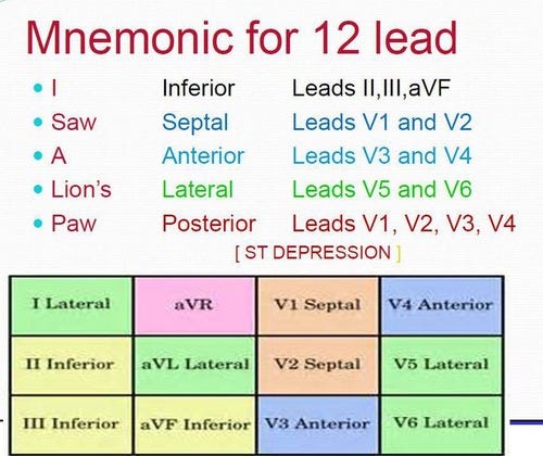 Decoding the ECG: A 12-Lead Interpretation Guide for Students” | Medium