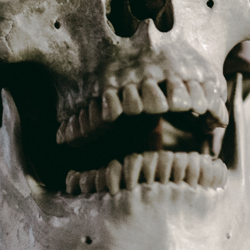 Pearly White Rotten Teeth. Pearly white rotten teeth | by Josh Hinton ...