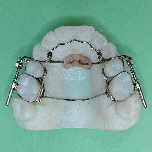 My Layman Response to the Bone Remodelling White Paper, Part 1 | by ...