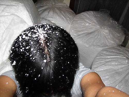 Worst Dandruff Ever