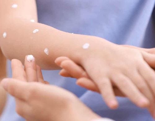 Skin Health for Kids: Understanding the Importance of Age-Appropriate ...