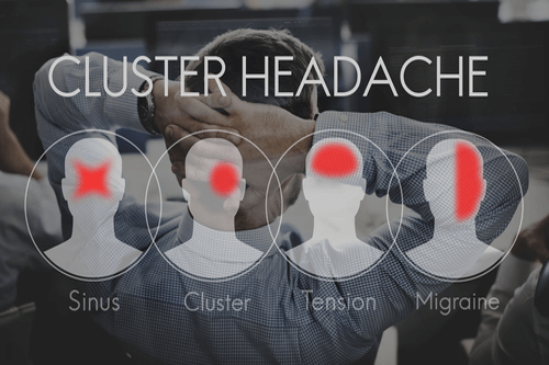 Cluster Headache: What It Is, Symptoms, Causes, Diagnosis and Treatment ...