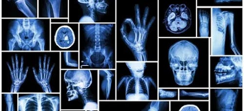 Public Medical Imaging Datasets For Artificial Intelligence Models | by ...