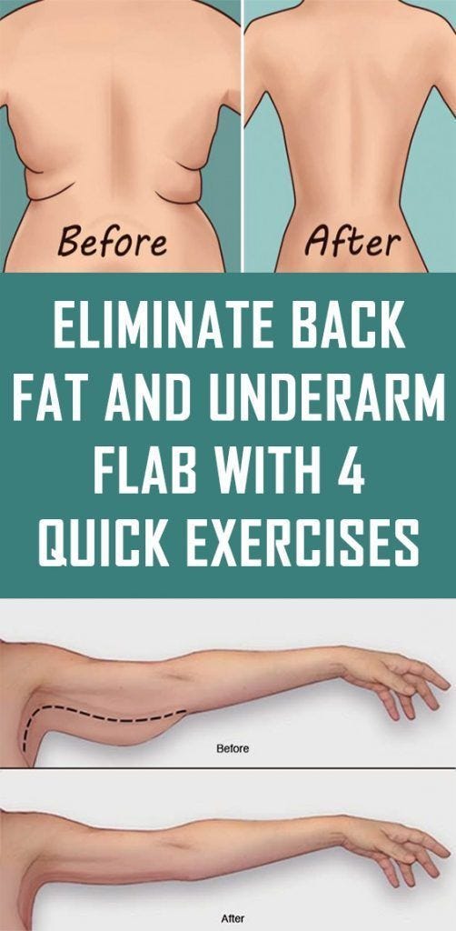 Remove back fat and underarm fat with just 4 workouts - Alice - Medium