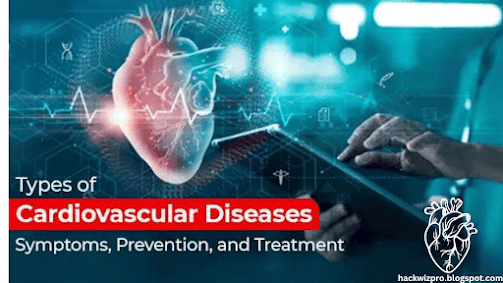 Understanding Cardiac Disease: Causes, Prevention, and Treatment | by ...
