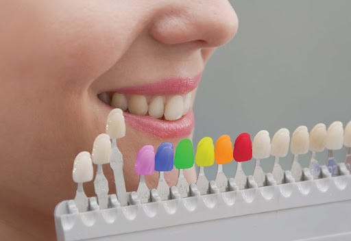 Why Should You Consider Tooth Coloured Fillings? | by Signature Smile ...