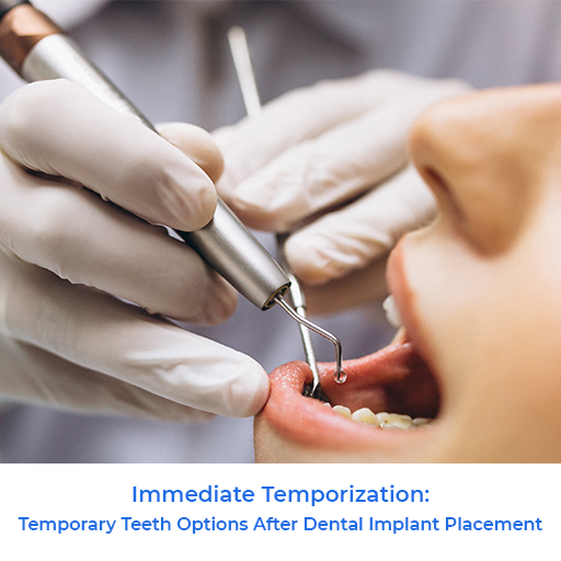 Immediate Temporization: Temporary Teeth Options After Dental Implant ...