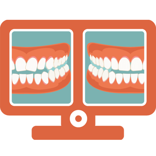 Improve Your Smile with Transparent Braces | by Guide lign | Jun, 2023 ...