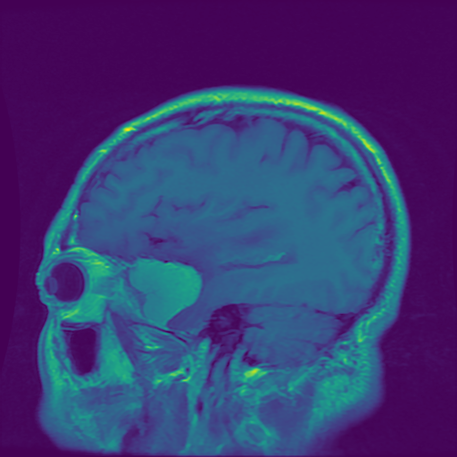 Building a Deep Learning Model for Brain Tumor Detection and ...