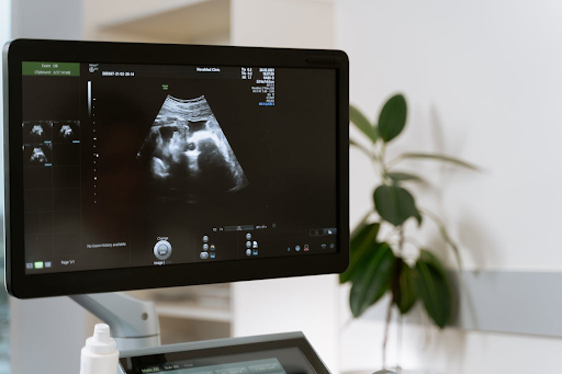 What’s an ultrasound?. An ultrasound scan is a safe and… | by ...