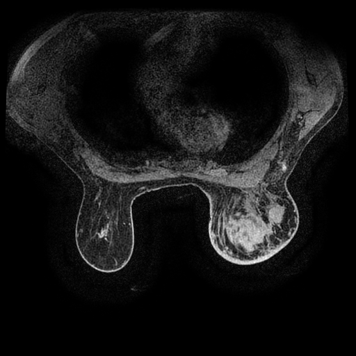 Train a Neural Network to Detect Breast MRI Tumors with PyTorch | by Nick Konz | Towards Data ...