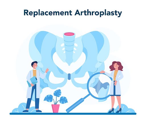 How Do I Know if My Hip Replacement Is Failing? | by Sahyadrihospital ...