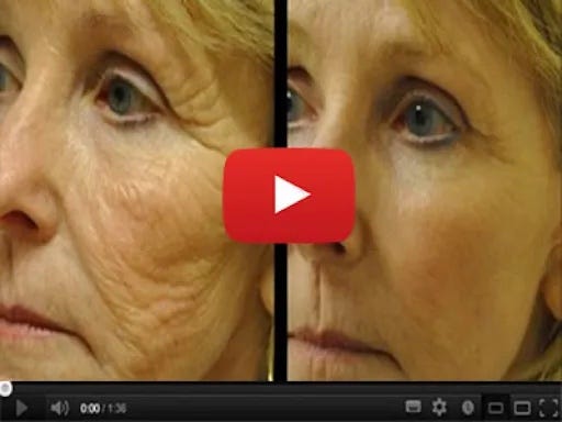 Uncover the Secret to Radiant, Wrinkle-Free Skin in 30 Days! - Remove ...
