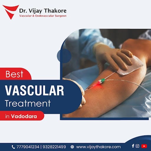 Best Vascular Treatment in Vadodara - Dr Vijaythakore - Medium