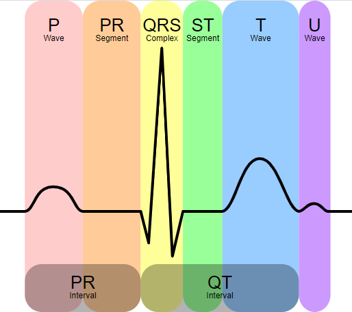 Interpretacion Electrocardiograma Ekg Interpretacion