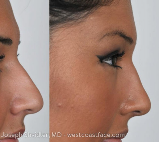 Facial Plastic Surgery Excellence in Anchorage, Alaska: Dr. William ...
