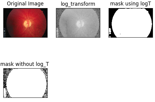 Image enhancement (contrast stretching using opencv & python) | by Sonu | Medium
