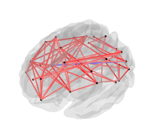 Intro To Graph Neural Networks And Autism Prediction With Fmri Data By Nandhu Manoj Pillai