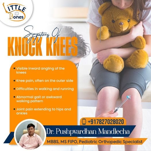 Best Treatment for Knock Knee in Indore | Dr. Pushpvardhan Mandlecha - Dr. Pushpvardhan ...