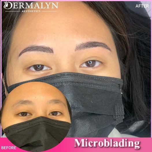 Microblading Eyebrows In Delhi - DermalynAesthetics - Medium