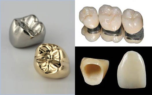 Advantages of Metal Free Crown Treatment | by Saurabh Singh | Medium