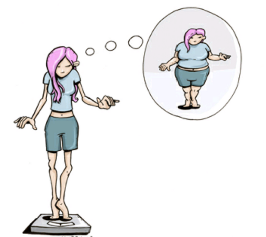 Bulimia Nervosa Cartoon