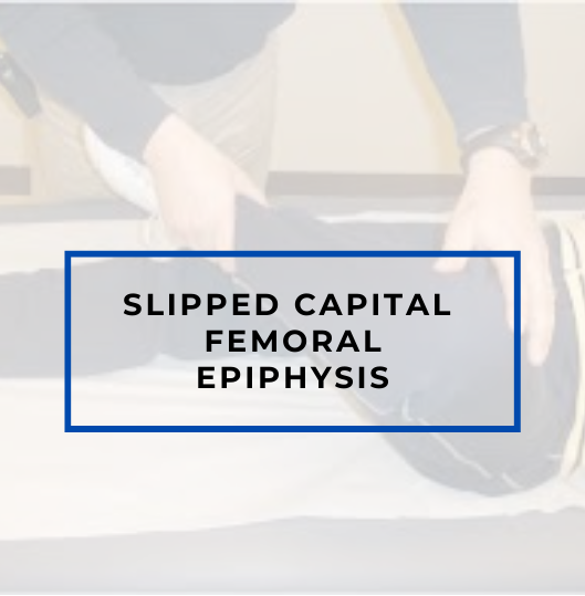 Slipped Capital Femoral Epiphysis (SCFE) discussion with Best ...