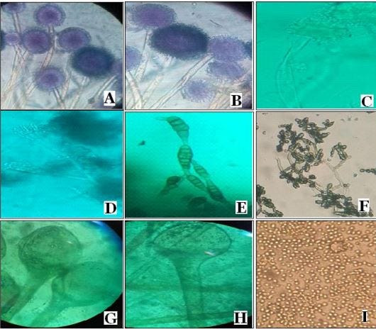 Common Fungi Found on Spoiled Fruits in Local Markets | by Openaccess ...