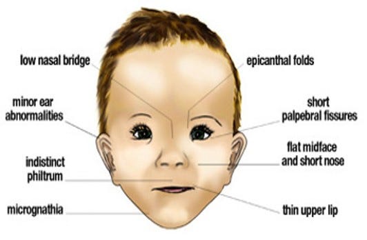 Effects of Teratogens on the Developing Fetus | by Kaylee M Luke | Apr ...