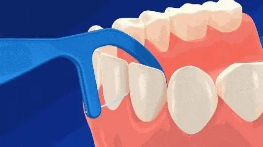 Are water flossers better than conventional flossing? | by yang chun ...
