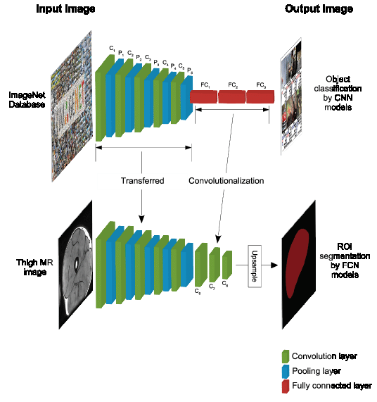 Revolutionizing Medical Imaging with YOLO: Detecting Bone Fractures in X-rays using Computer ...