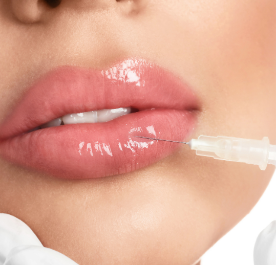 Unlocking the Pout: Top Reasons Why People Opt for Lip Filler ...