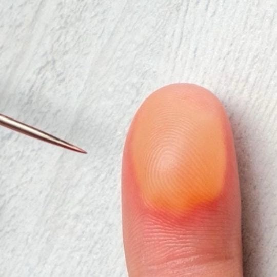 Knuckles and blisters. The beginning of a trauma journey | by Ornery ...