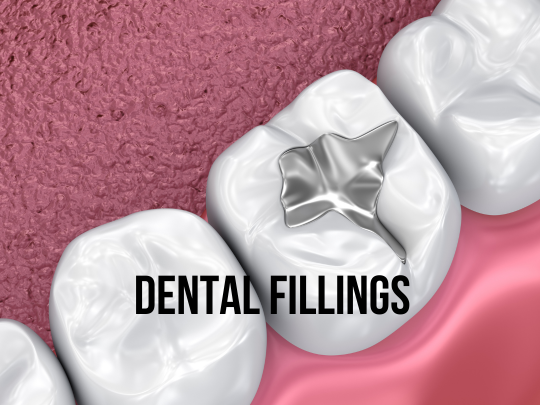 Dental Fillings: What to Expect and How to Care for Your Teeth ...