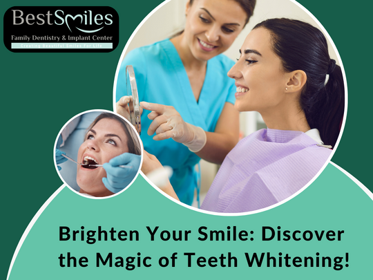 Brighten Your Smile: Discover the Magic of Teeth Whitening | by Best ...