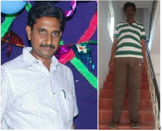 Lungs&Heart transplantation, help Ramesh | by Sateesh Kumar | Medium