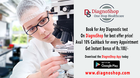 book diagnostic tests online at jubilee hills | cheapest diagnostic ...