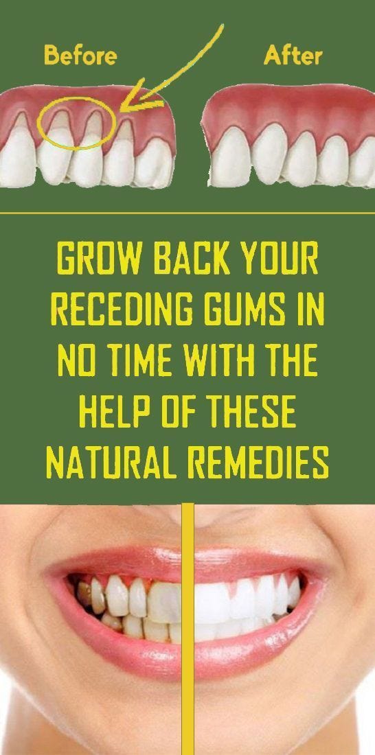 Grow Back Your Receding Gums With The Help Of These Natural Remedies ...