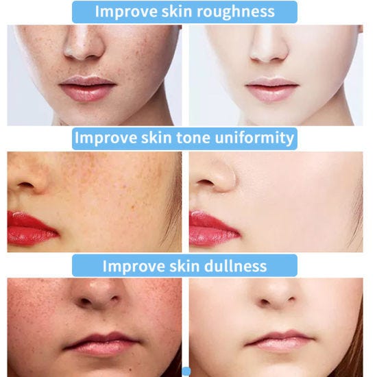 Re ViVium Cream Review Natural That Helps To Care Skin Problems Easily ...